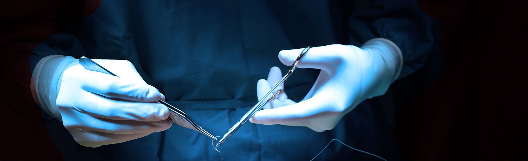 Surgical Error Negligence Claims | Digby Brown Solicitors